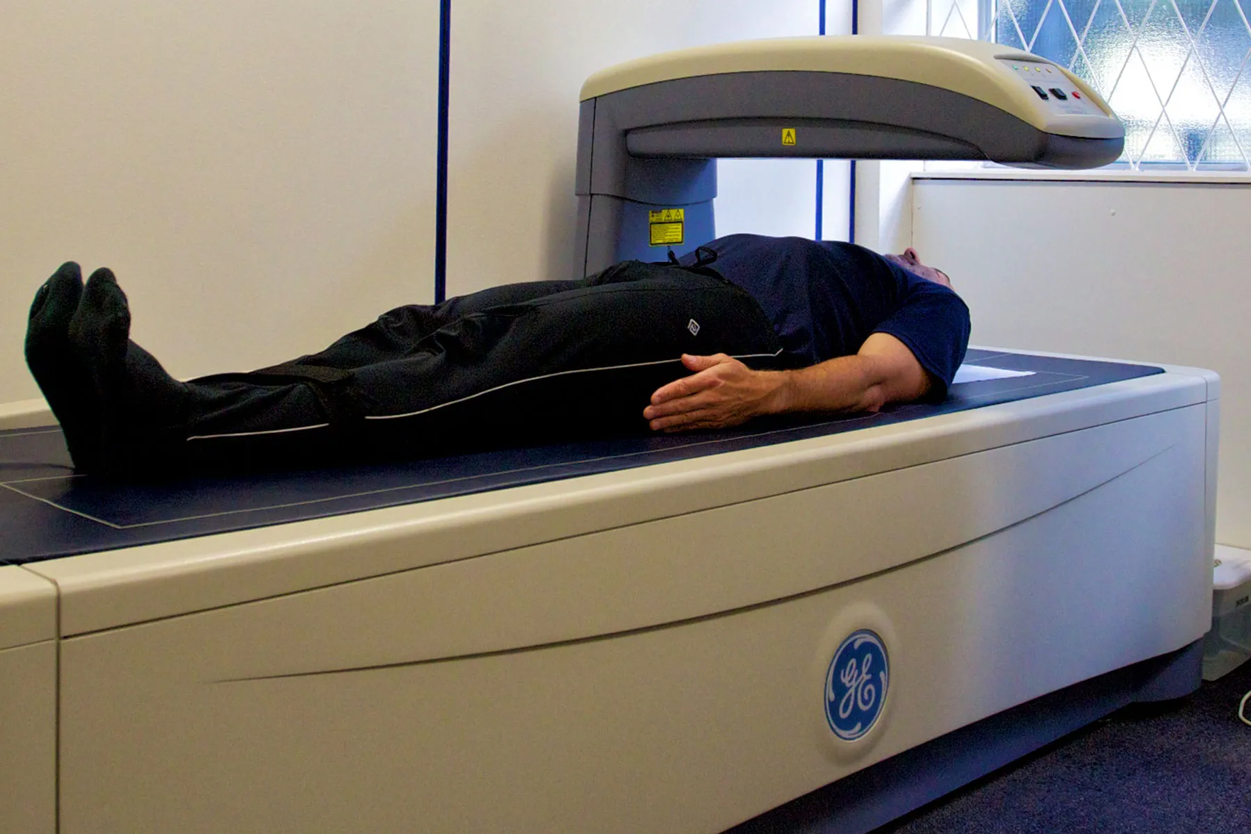 DEXA Scan (Dual X-ray Absorptiometry): A Test to Measure Bone Mineral ...