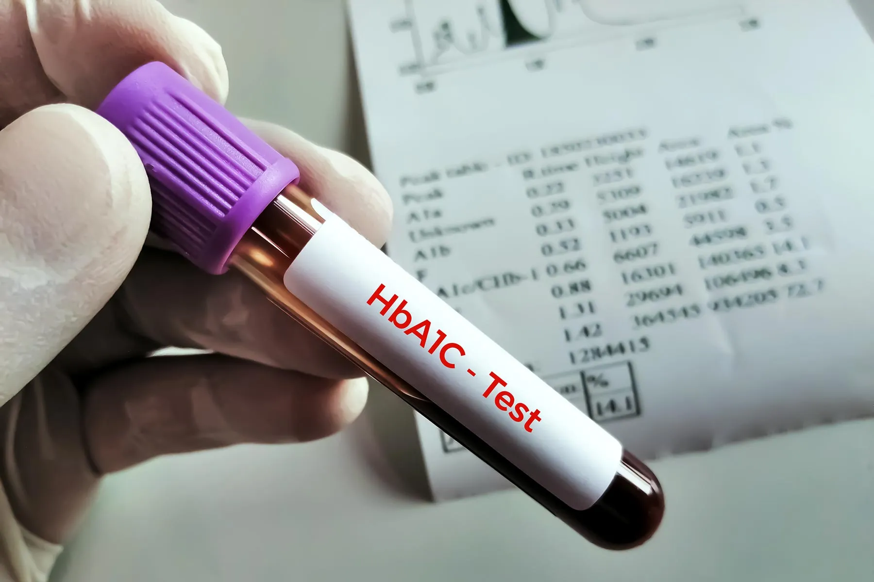 HbA1c (Hemoglobin A1c): A1c Chart, Test, Levels, & Normal Range