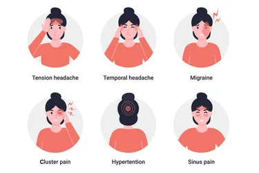 Headache Locations: A Comprehensive Guide