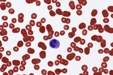 Low White Blood Cell Count: Causes and Solutions
