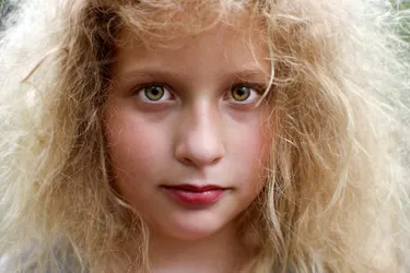 What You Should Know About Uncombable Hair Syndrome
