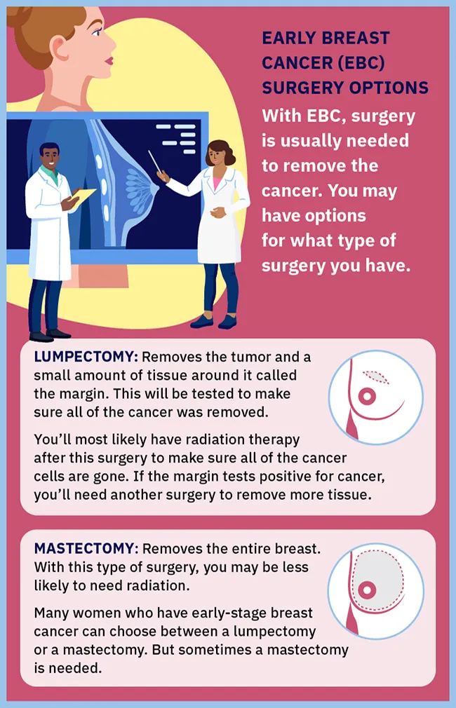 Surgery for Early-Stage Breast Cancer