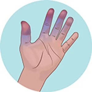 Symptoms of Poor Circulation