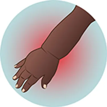 Symptoms of Poor Circulation