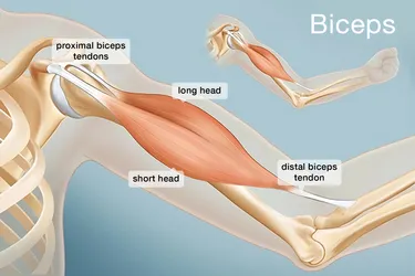Biceps Rupture: What Causes A Popeye’s Muscle Deformity?