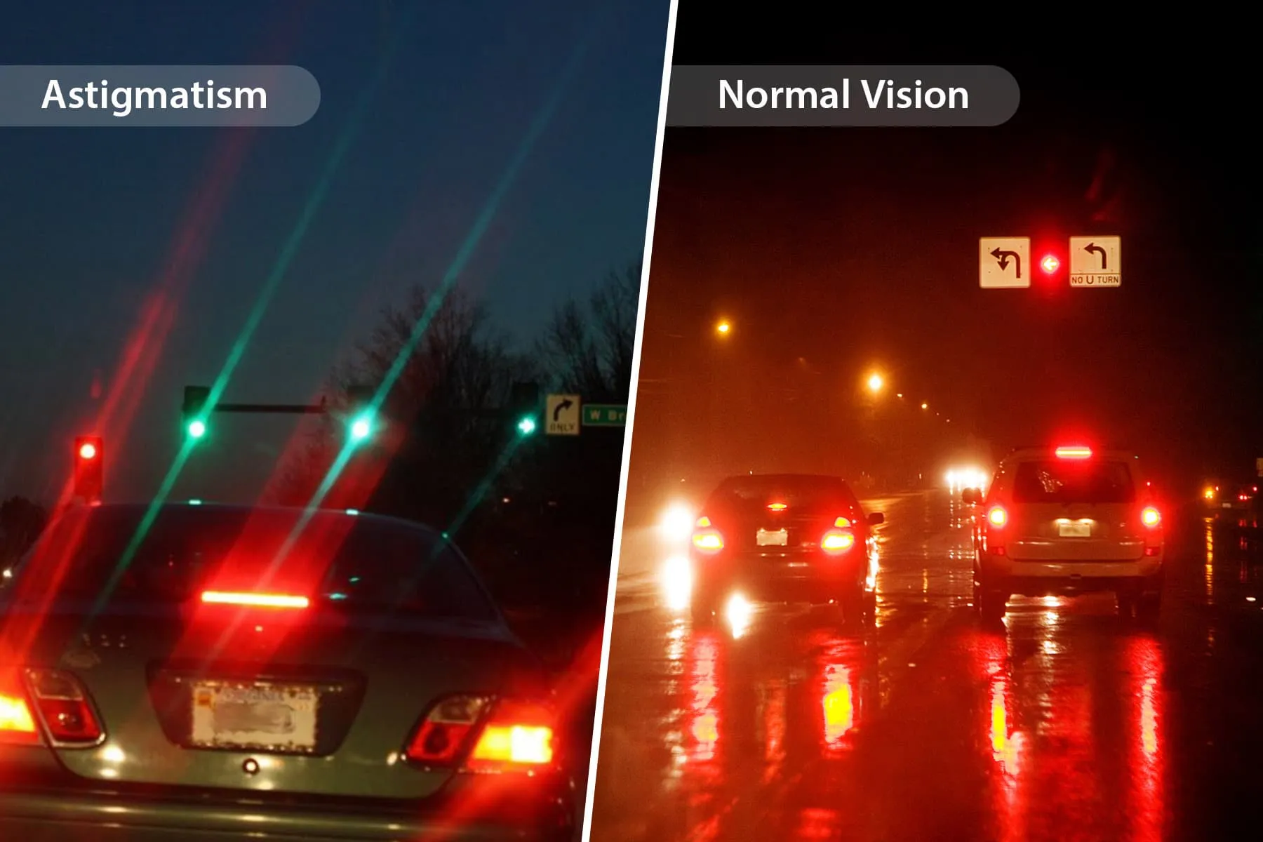 Astigmatism Causes Symptoms Diagnosis And Treatment