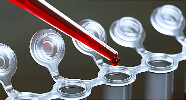 HIV Testing: Antibody Tests and Home Tests