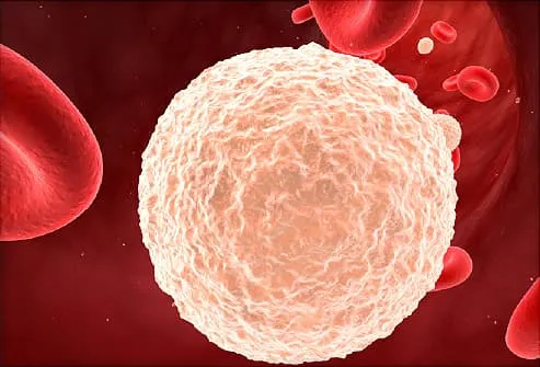 CD4 Count, HIV, and AIDS: Test and Results, What They Mean