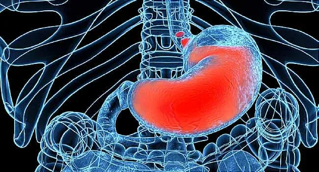 The Risks of Untreated Heartburn and GERD