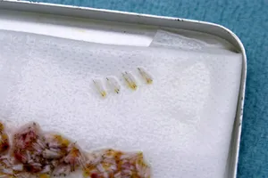 Hair Transplant Procedures: Average Cost, What to Expect, and More