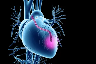 Heart Bypass Surgery: Purpose, Procedure, Risks, Recovery