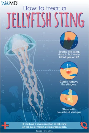 First Aid Treatment for Jellyfish Stings