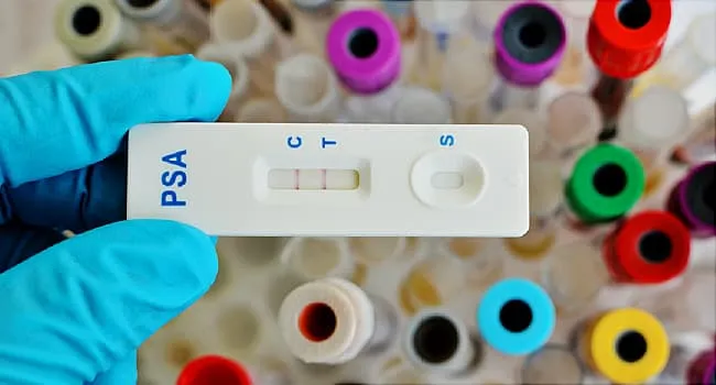 Advanced Prostate Cancer: When PSA Levels Change