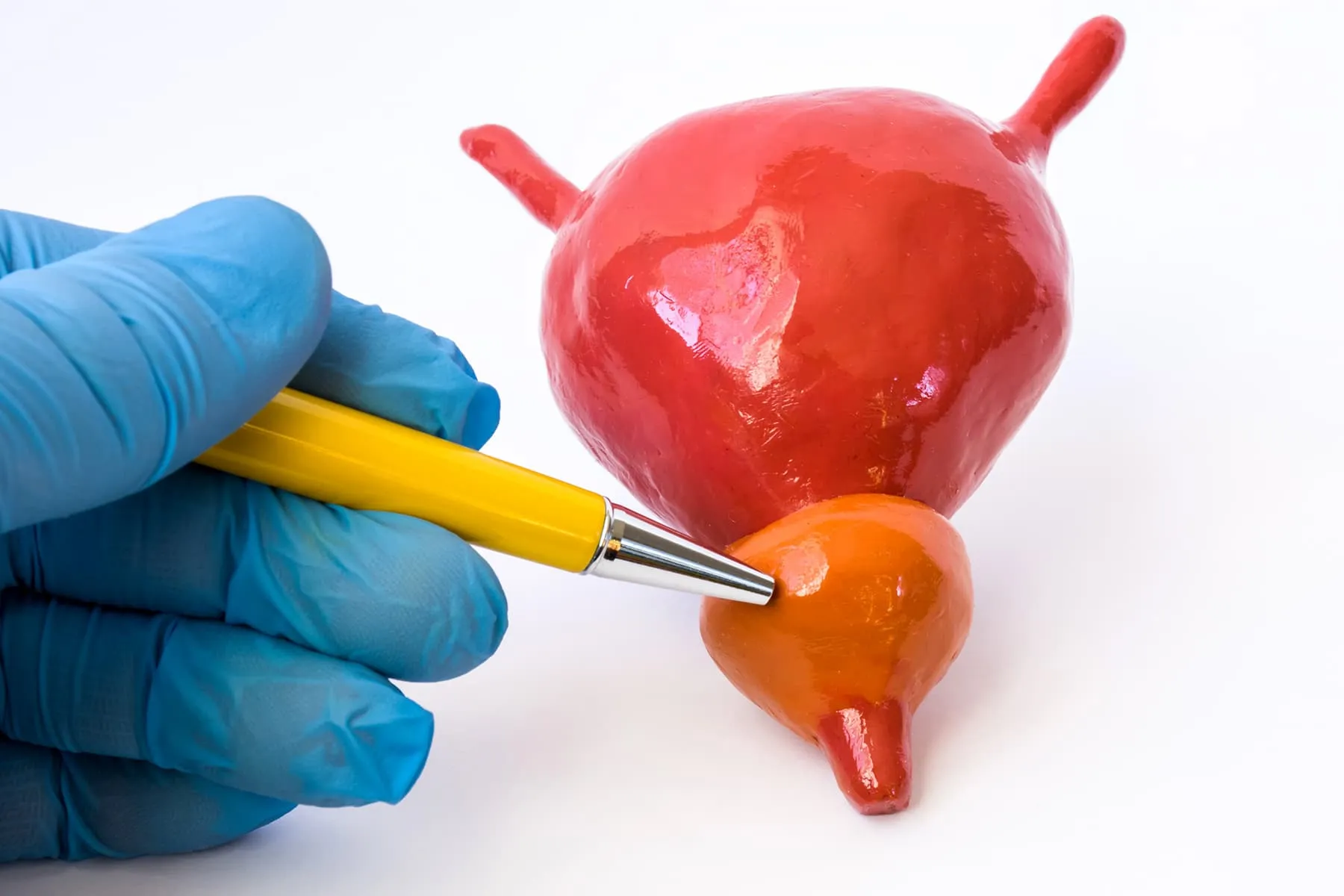 PSMA: How It Can Help Treat Prostate Cancer