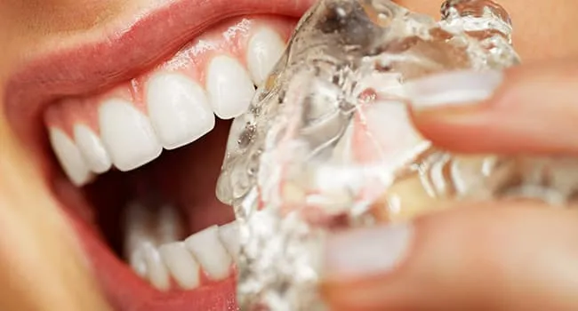 19 Habits That Wreck Your Teeth