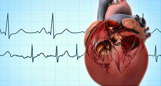 Atrial Fibrillation Ecg Test Pictures Symptoms Causes Tests And More