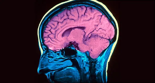 Bipolar Disorder: Symptoms, Causes, and More