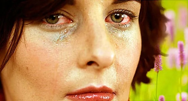 Eye Allergies: Symptoms, Triggers, Treatments