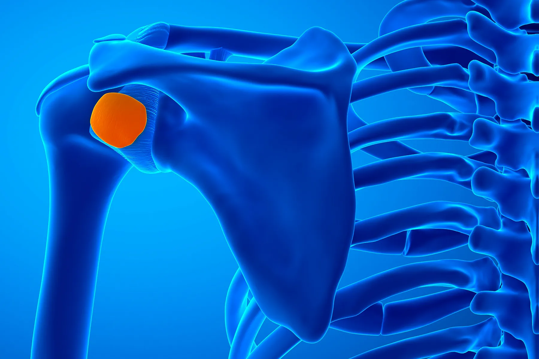 Visual Guide to Bursitis