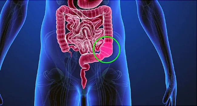 Reasons You May Be Constipated