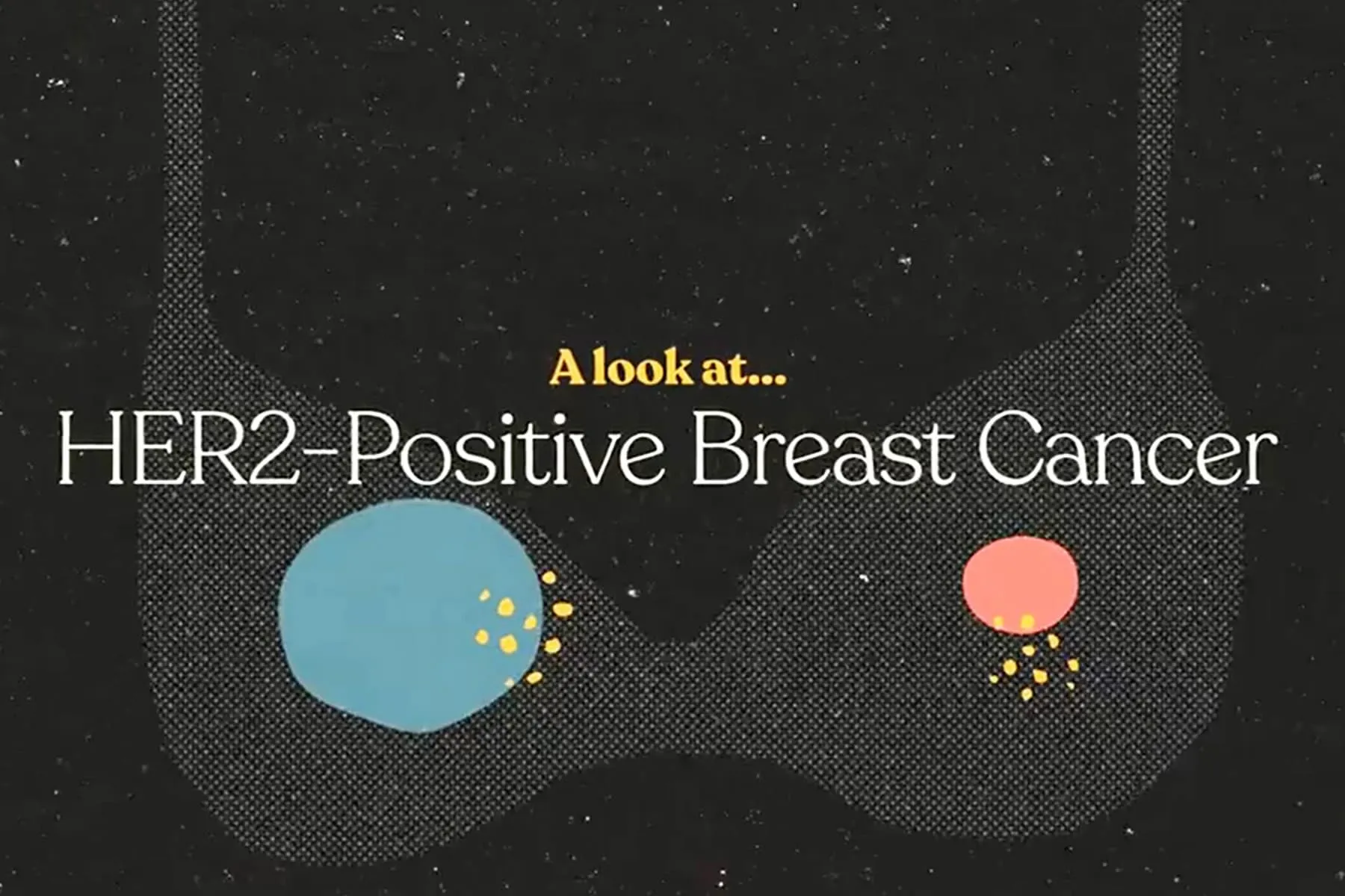 A Look at HER2+ Breast Cancer