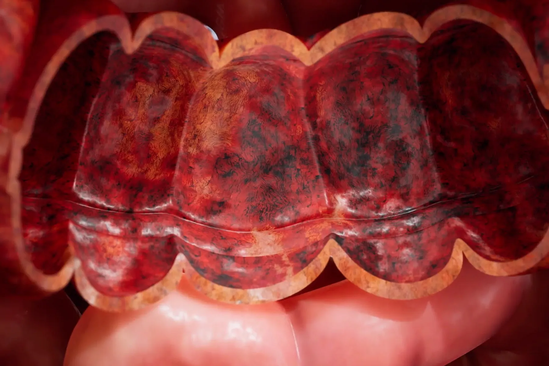 How UC Medications Work Inside Your Body