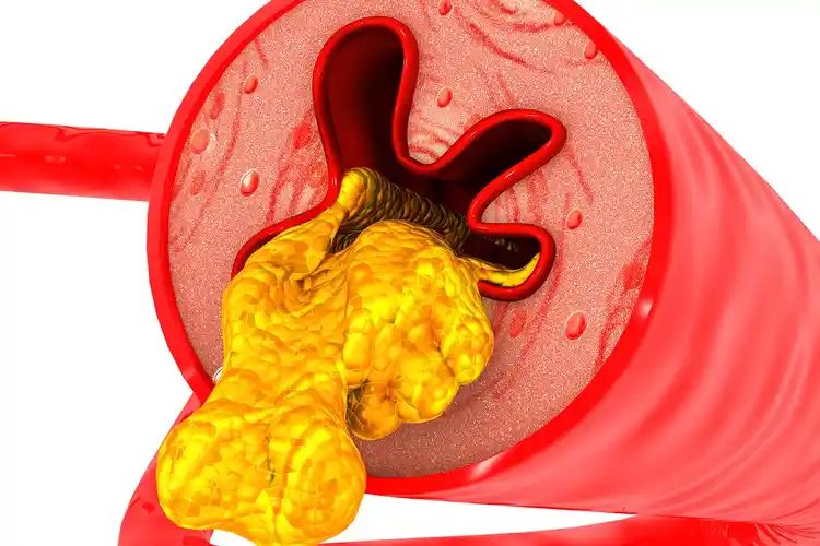 Ask The Expert: What is Cholesterol?