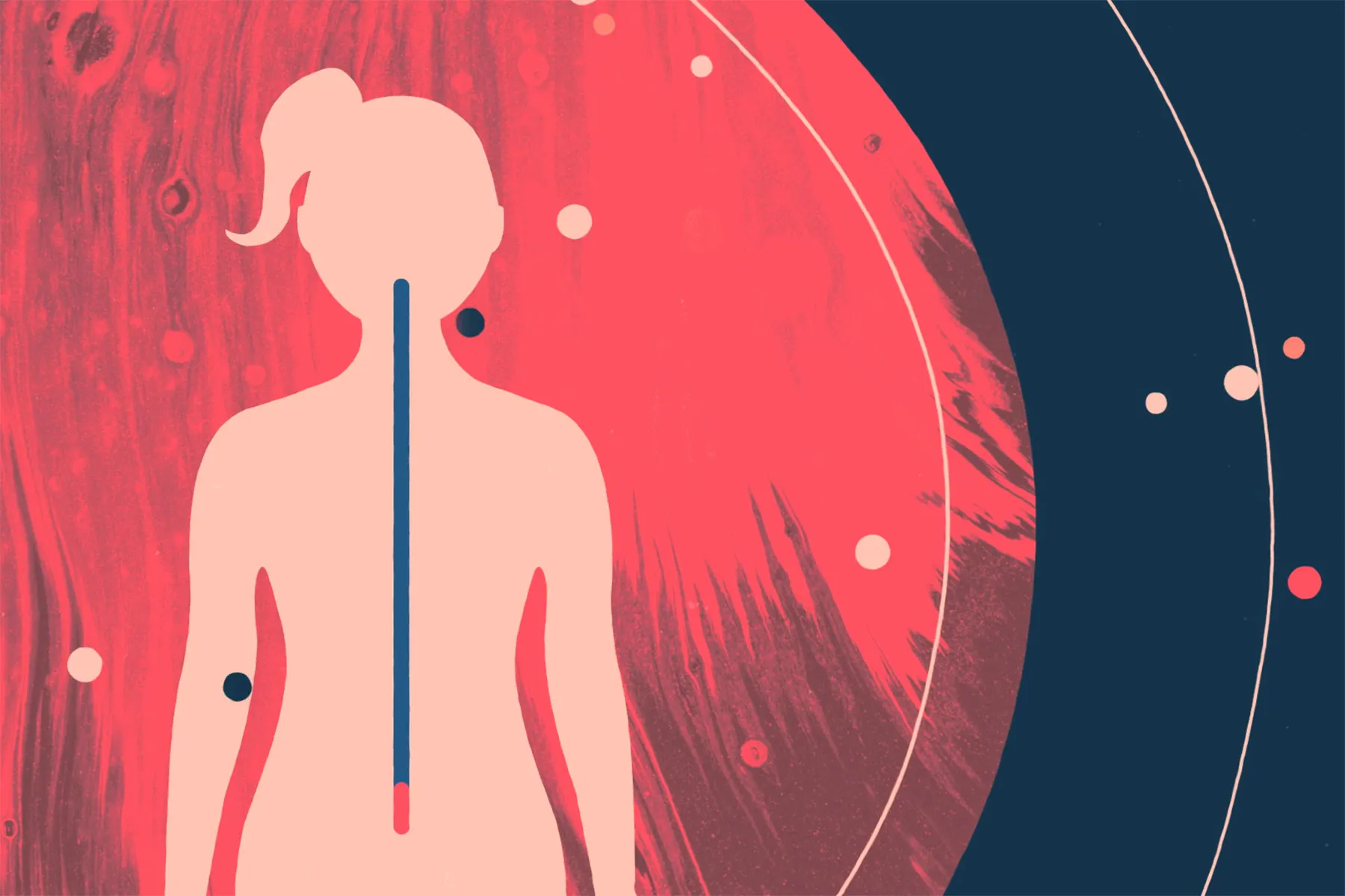 What Is Type 1 Diabetes 