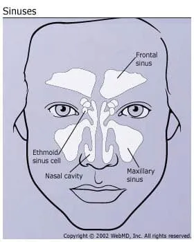 Sinus Headaches - Symptoms, Causes, and Treatment