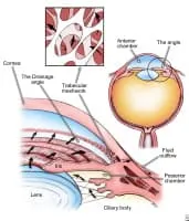 Ocular Hypertension: Causes, Symptoms, Tests, and Treatment
