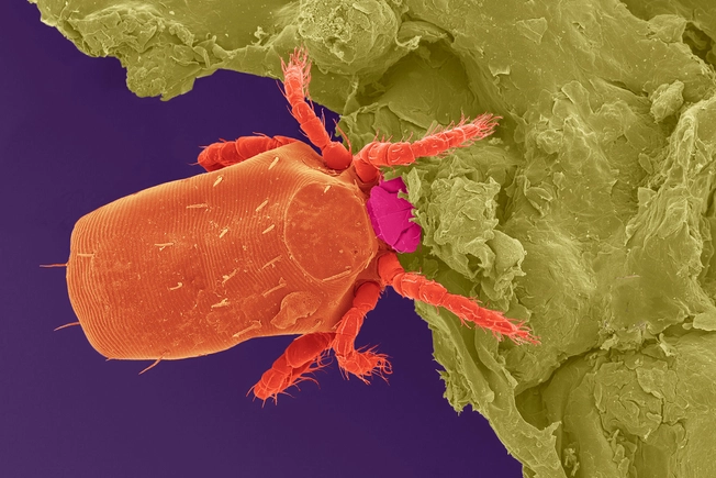 Bug Bites Pictures: Identifying Bugs and Bug Bites