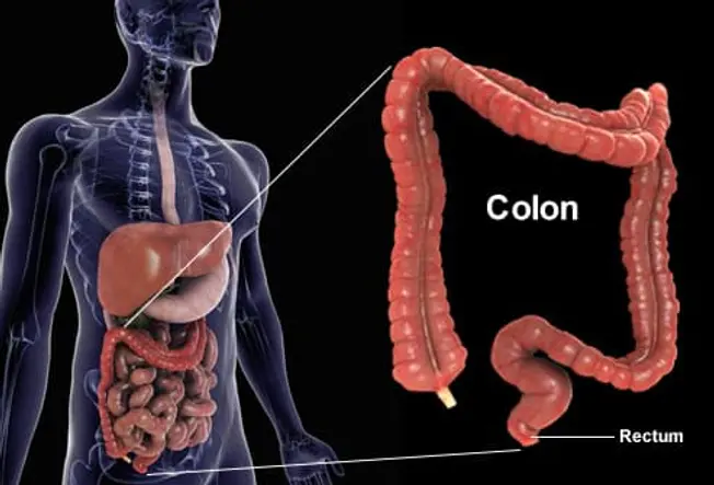 Colorectal Cancer Screening Tests, Stages, Symptoms, Treatments, and ...