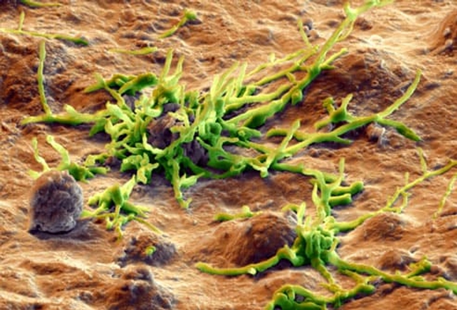 Eye Allergies: Symptoms, Triggers, Treatments