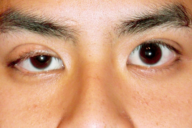 What Your Eye Symptoms Could Mean