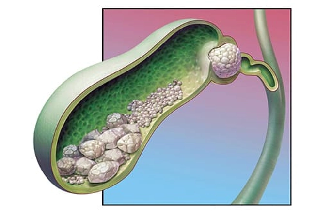 Visual Guide To Your Gallbladder