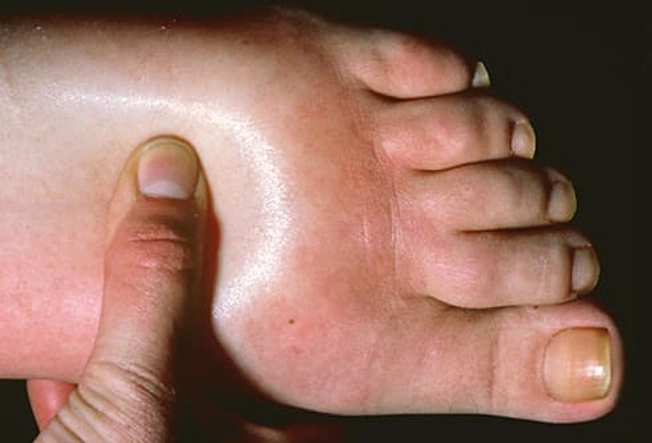 How Heart Disease Affects Your Body