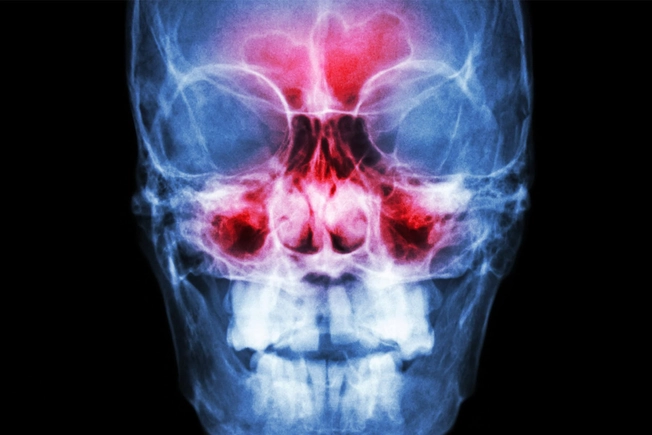 What infections aren’t contagious?