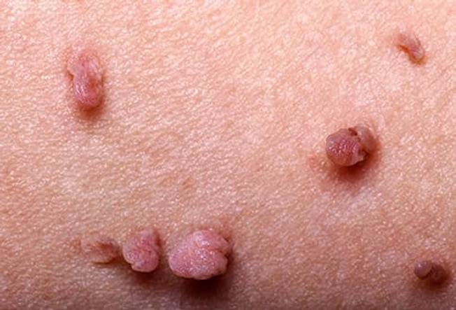 Weird Things That Happen to Your Skin as You Age