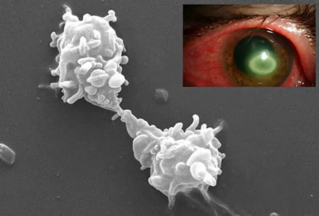 Bugs That Burrow Under Skin