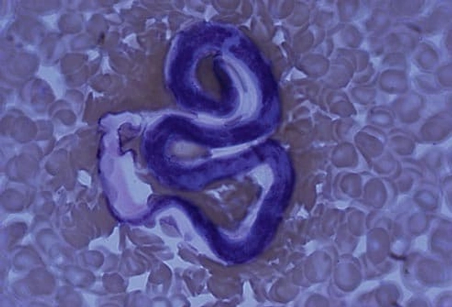 Bugs That Burrow Under Skin