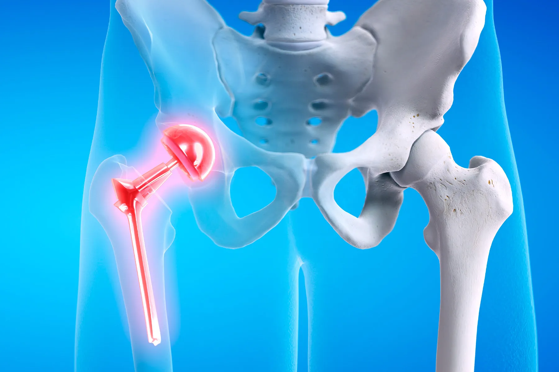 Few Age Limitations For Joint Substitute OLDERNEWS