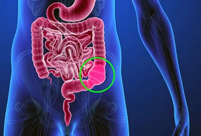 Reasons You May Be Constipated