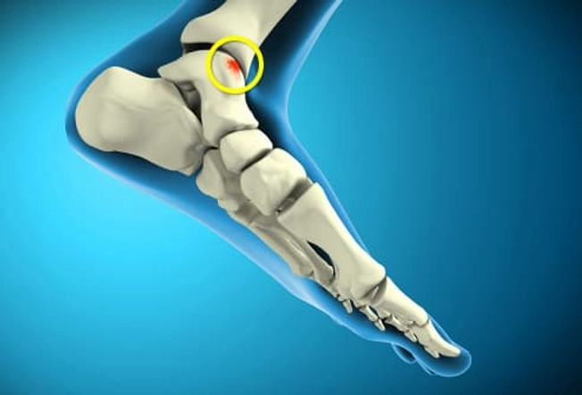 Why Does My Ankle Hurt? 15 Possible Causes of Ankle Pain